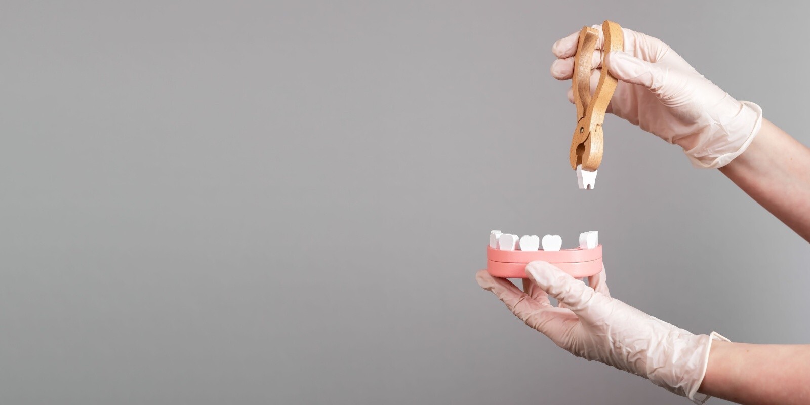 Atraumatic Tooth extraction - Dental Designs