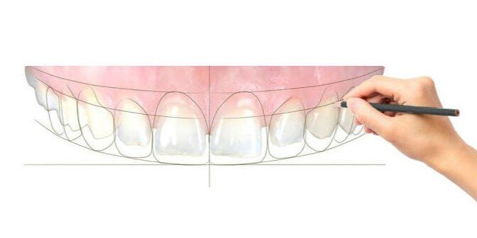 Digital Cosmetic Smile Design For Smile Makeovers - Dental Designs