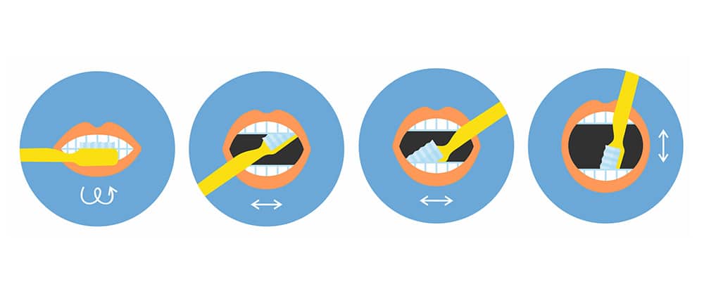 How Often To Scale And Polish Teeth - Dental Designs Clinic Singapore