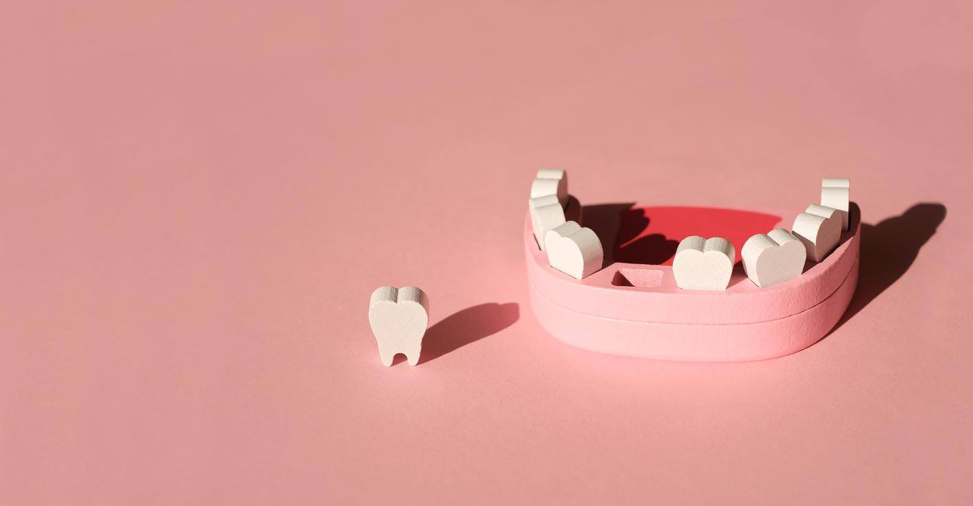 Mystery of Wisdom Teeth: Everything You Need to Know - Dental Designs