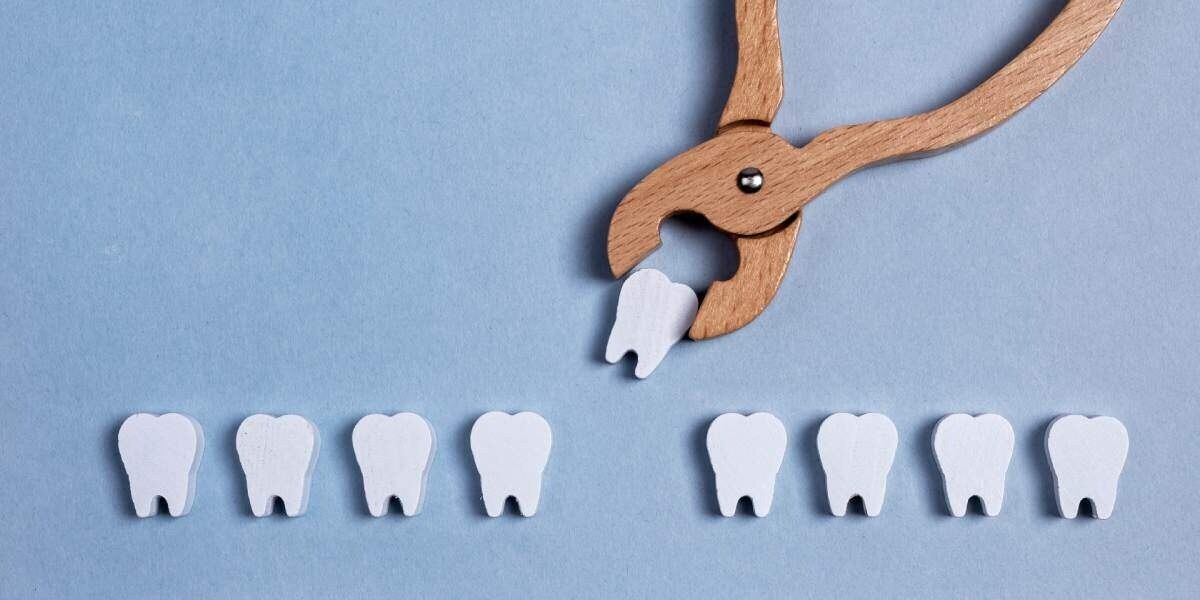 Wisdom Tooth Extraction Cost in Singapore 2026 -Dental Designs Clinic